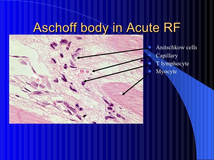 RHEUMATIC HEART DISEASE BY DR BASHIR AHMED DAR ASSOCIATE PROFESSOR ME…