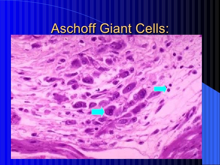 RHEUMATIC HEART DISEASE BY DR BASHIR AHMED DAR ASSOCIATE PROFESSOR ME…