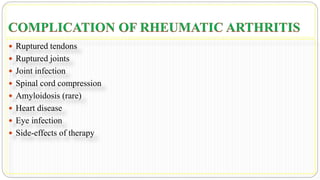 Rheumatic arthritis ppt niha | PPT