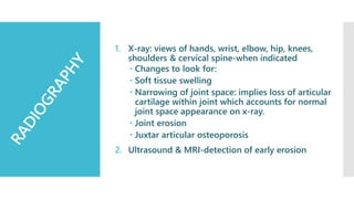 Rheumatic arthritis-Investigations | PPTX