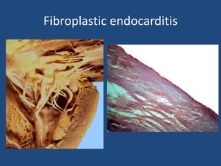 Rheumatic diseases pathology anatomy disease | PPTX