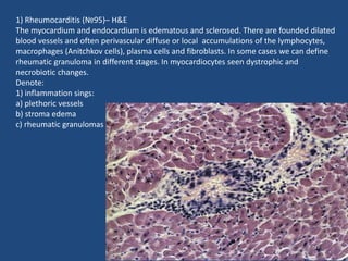 Rheumatic diseases pathology anatomy disease | PPTX