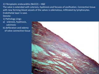 Rheumatic diseases pathology anatomy disease | PPTX
