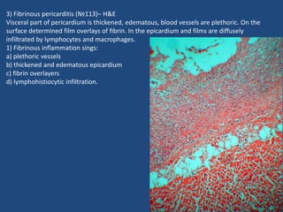 Rheumatic diseases pathology anatomy disease | PPTX
