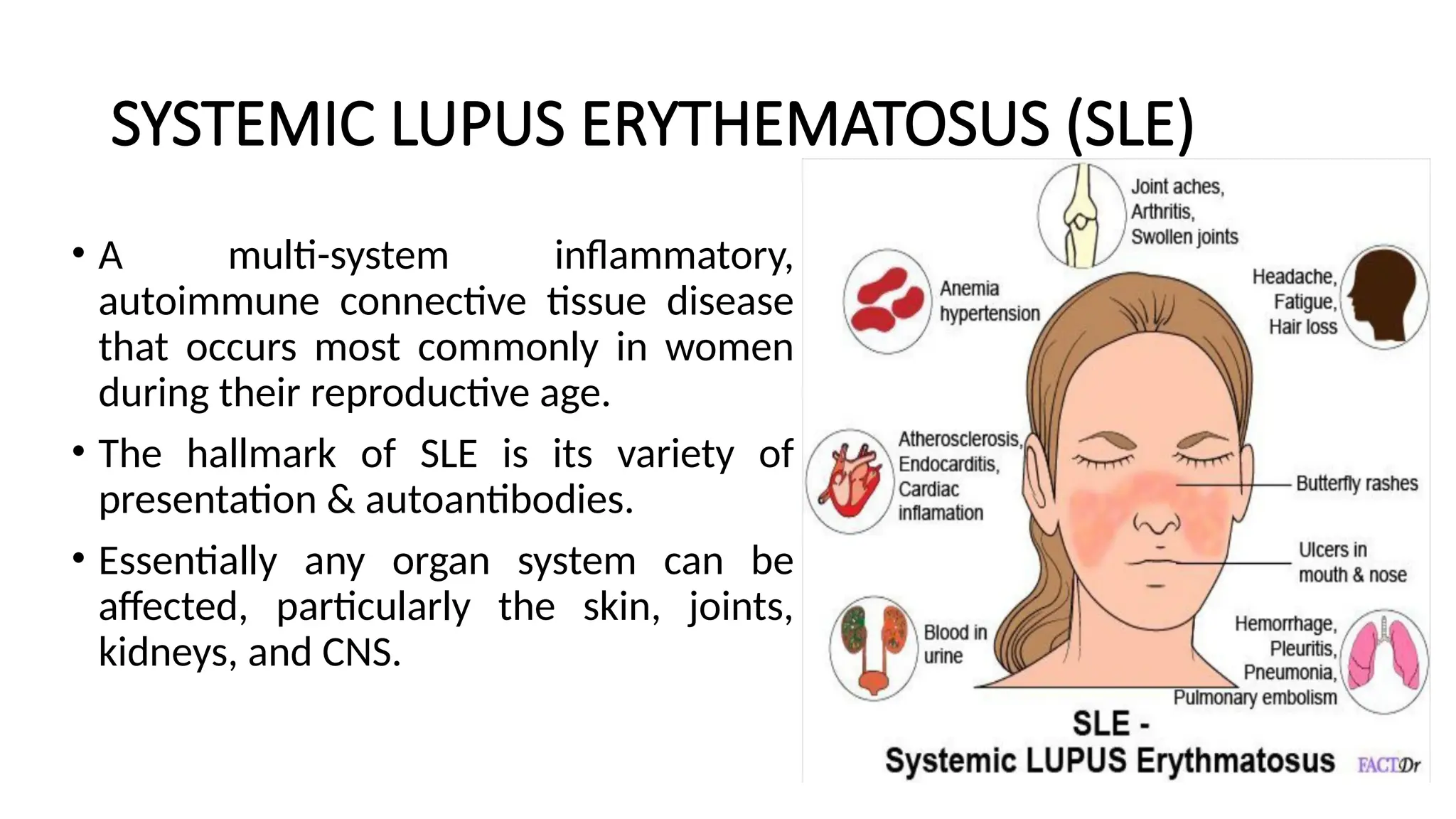 Rheumatic Disorders (Systemic Lupus Erythematosus (SLE) with ...