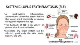 Rheumatic Disorders (Systemic Lupus Erythematosus (SLE) with ...