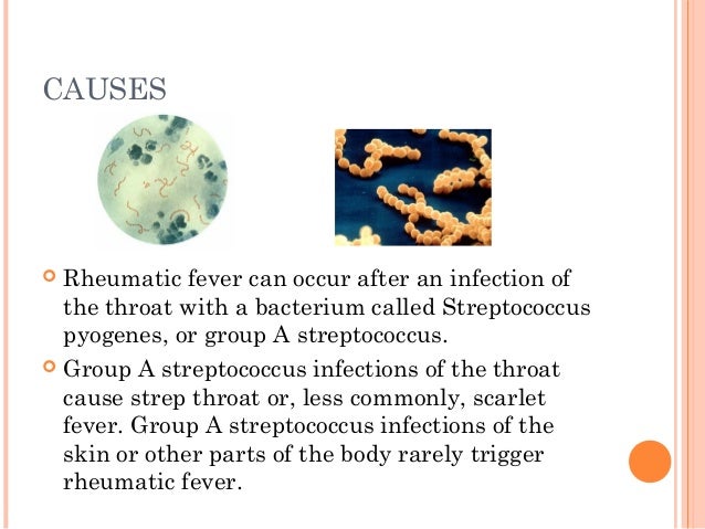 Streptococcus Group A Rheumatic Fever