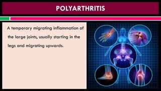 Pathophysiology of Rheumatic fever | PDF