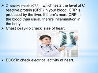 Rheumatic fever | PPT