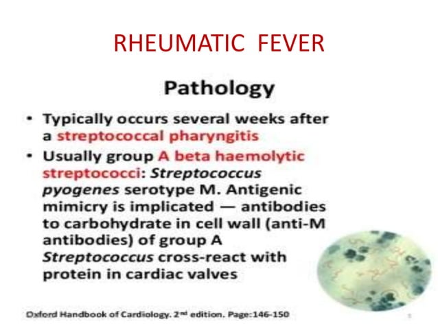Rheumatic fever | PPT