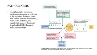 Rheumatic fever | PPT