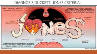 RHEUMATIC FEVER.pptx