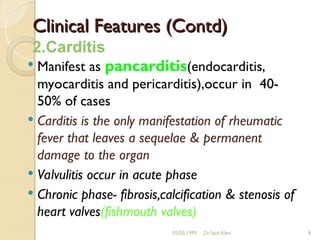 rheumatic fever.ppt88888888888888888888888888888888 | PPT