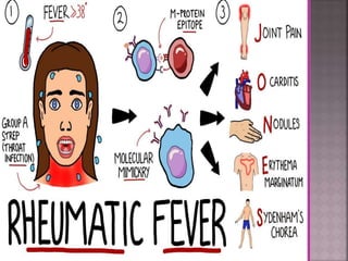 Rheumatic fever 1.pptx