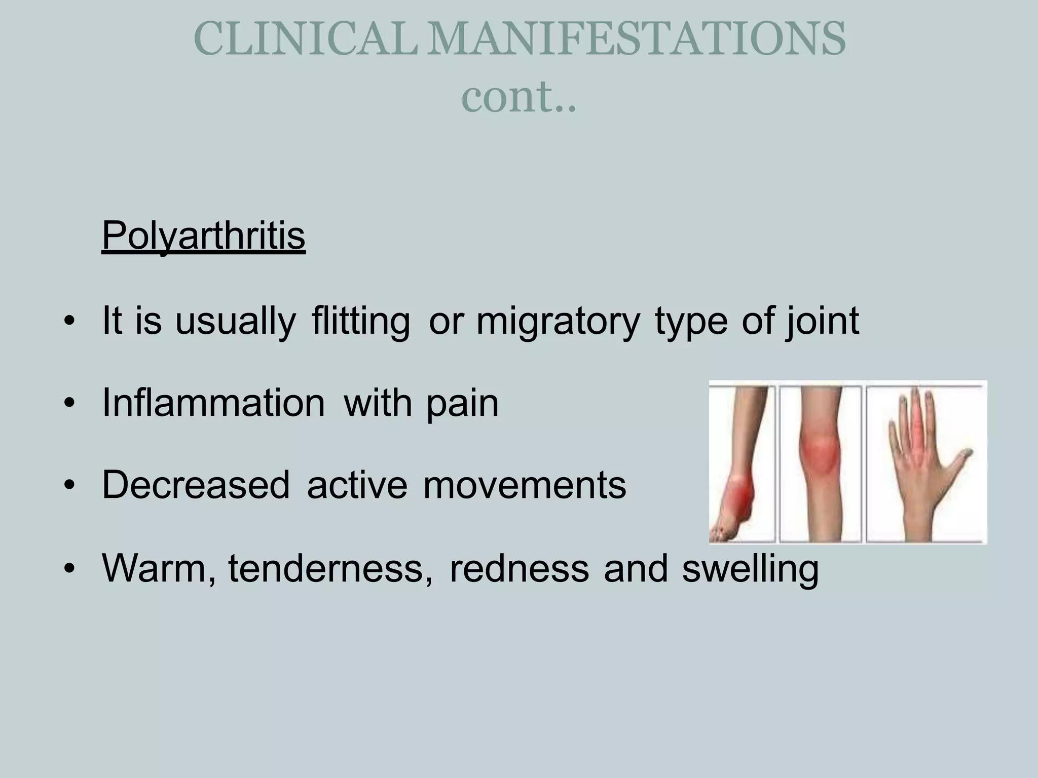 RHEUMATIC_FEVER (1).pptx