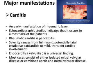 Rheumatic fever | PPTX