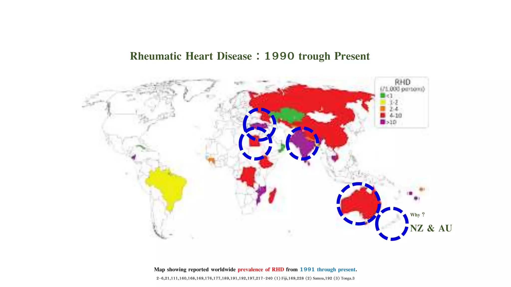 Rheumatic fever ( criteria for diagnosis )( ff ) | PPT