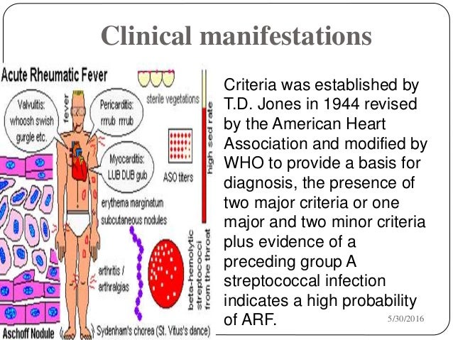 Pathophysiology Of Rheumatic Fever