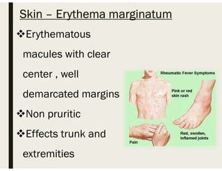 RHEUMATIC FEVER PPT .pdf