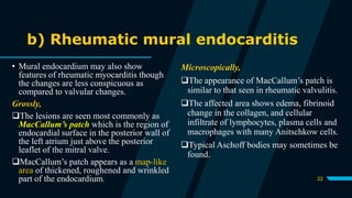 RHEUMATIC FEVER & RHEUMATIC HEART DISEASE | PPTX