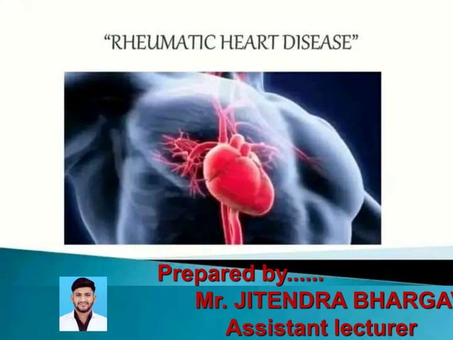 RHEUMATIC HEART DISEASE SLIDESHARE | PPT