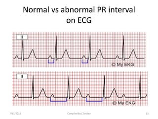 Rheumatic heart disease | PDF | Heart and Cardiovascular Diseases ...