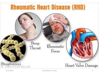 Rheumatic heart disease | PDF | Heart and Cardiovascular Diseases ...