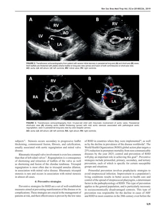 Rheumatic heart disease | PDF