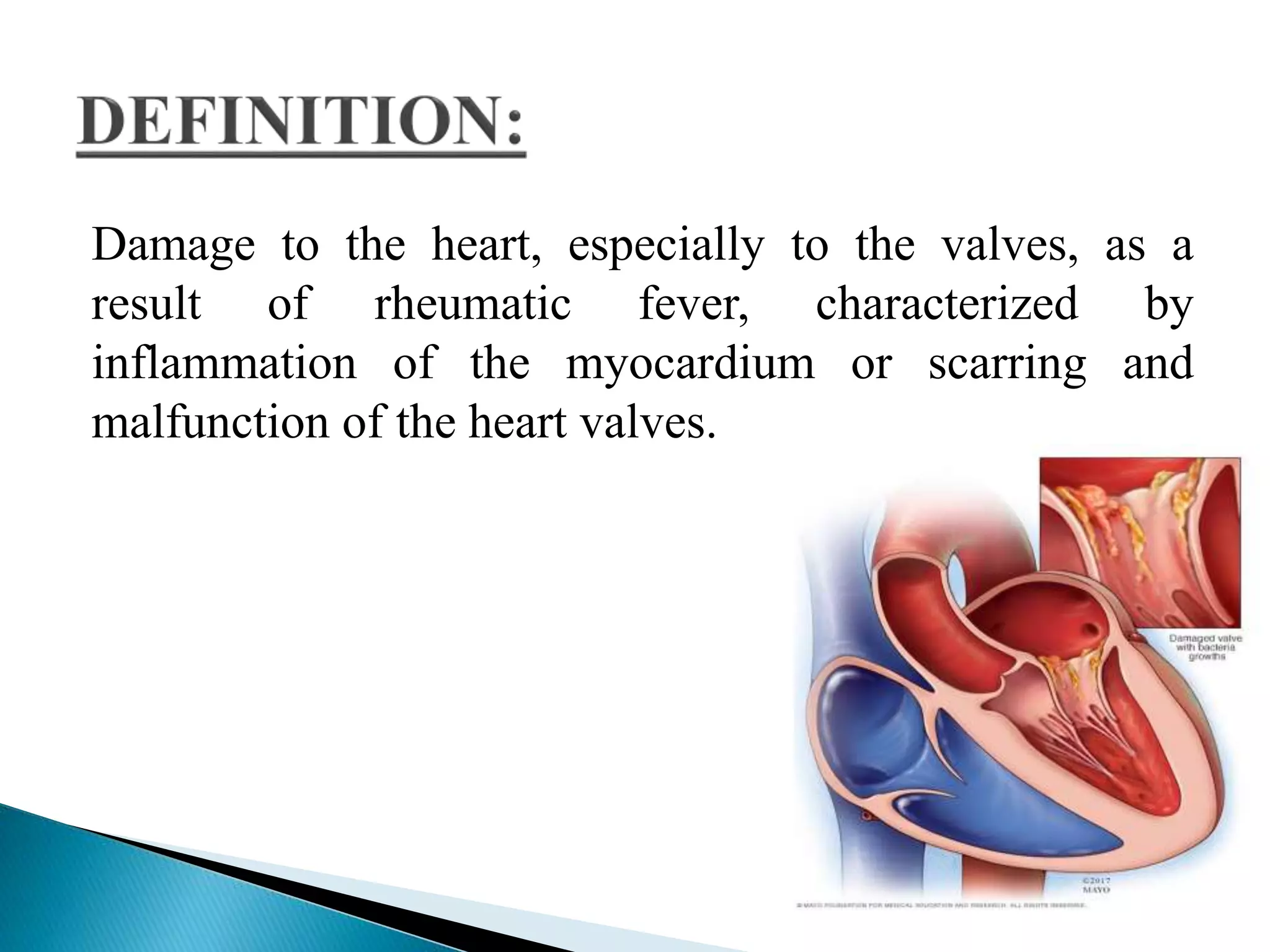 Rheumatic heart disease | PPTX