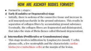 Rheumatic Heart Disease | PPT