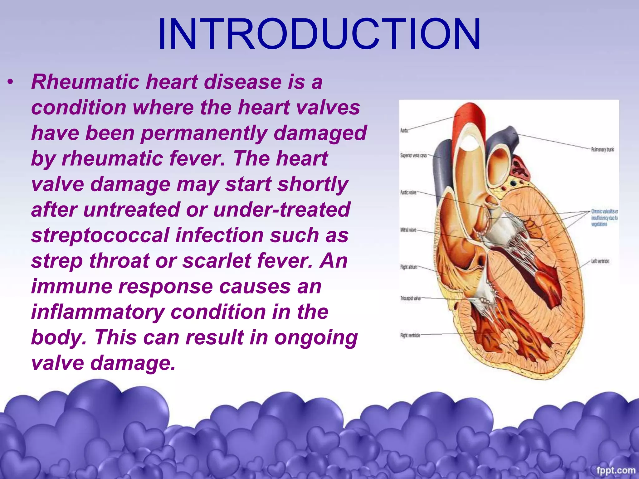 Rheumatic heart disease | PPTX