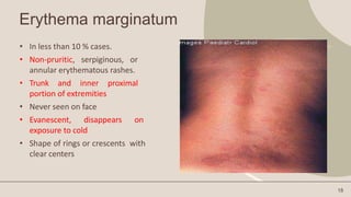 Rheumatic Heart Disease.pptx