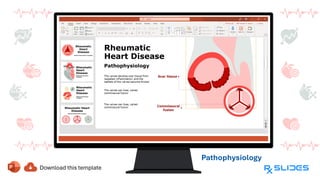 Rheumatic Heart Disease ( RHD ) | PDF
