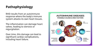 Rheumatic Heart shehsbhejeejjDisease.pptx