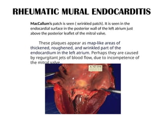 Rheumatic_Heart_Disease by Ananya Singha | PPT