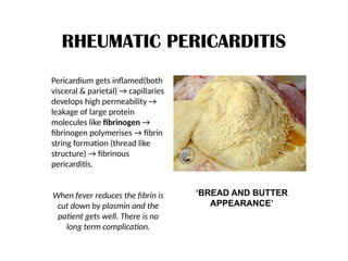 Rheumatic_Heart_Disease by Ananya Singha | PPT