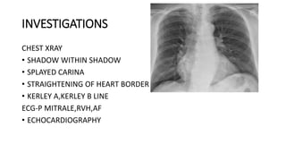 RHEUMATIC HEART DISEASE CLINICAL FEATURES AND DIAGNOSIS.pptx