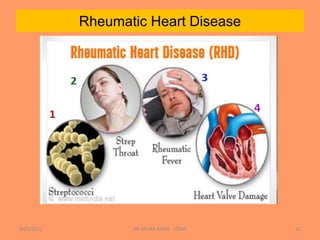 Rheumatic heart disease | PPT