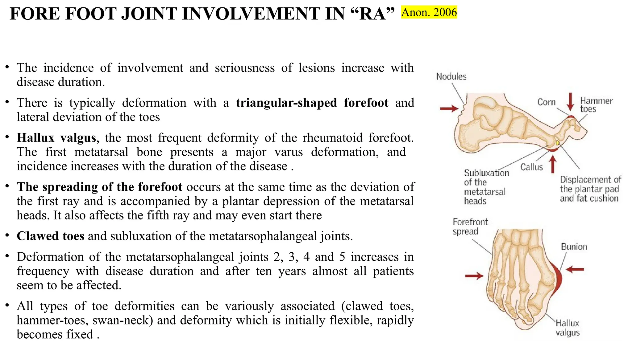 RHEUMATOID ARTHRITIS OF EXTRIMETIES AND SPINE .pptx