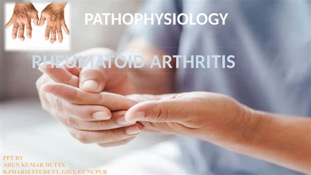 rheumatoid arthritis.pptx ppt by arun kumar dutta | PPTX