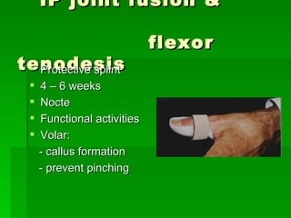 The Hand therapist's role: Rheumatoid Thumb - Splinting/Rehabilitation ...