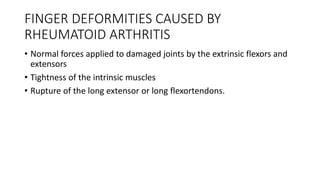 Deformities in rheumatoid arthriris.pptx