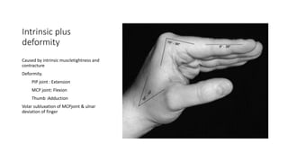 Deformities in rheumatoid arthriris.pptx