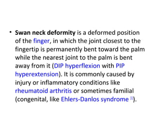 Rheumatoid arthritis | PPT