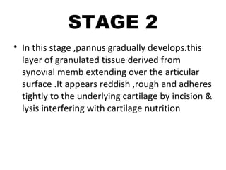Rheumatoid arthritis | PPT