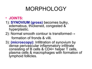 Rheumatoid arthritis | PPT | Bone and Joint Conditions | Diseases and ...