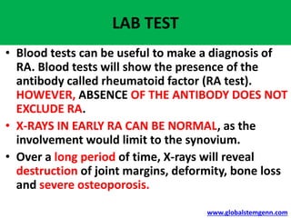 Medical Facts of STEM CELL THERAPY in Rheumatoid Arthritis | PPT