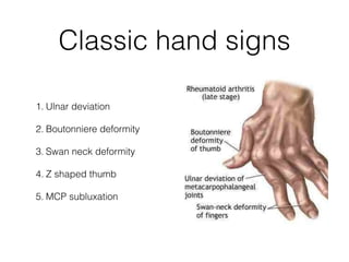 Rheumatoid arthritis - Dafydd Loughran | PPT