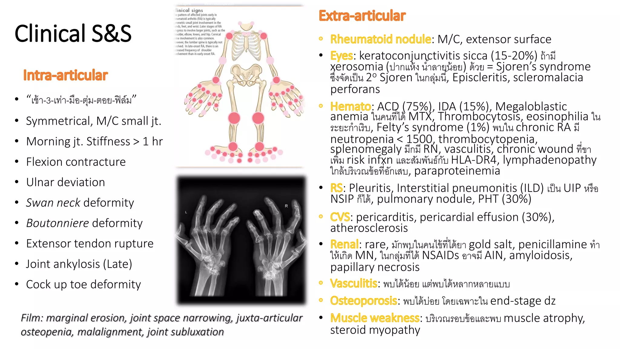 Rheumatoid arthritis | PDF