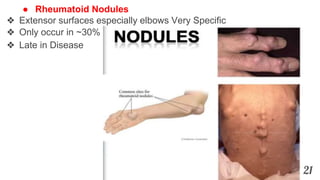 Rheumatoid arthritis 2019 | PPTX